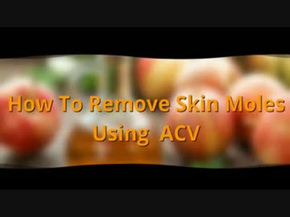 Simple Apple Cider Vinegar (ACV) Remedy for Skin Moles Actually Shows ...