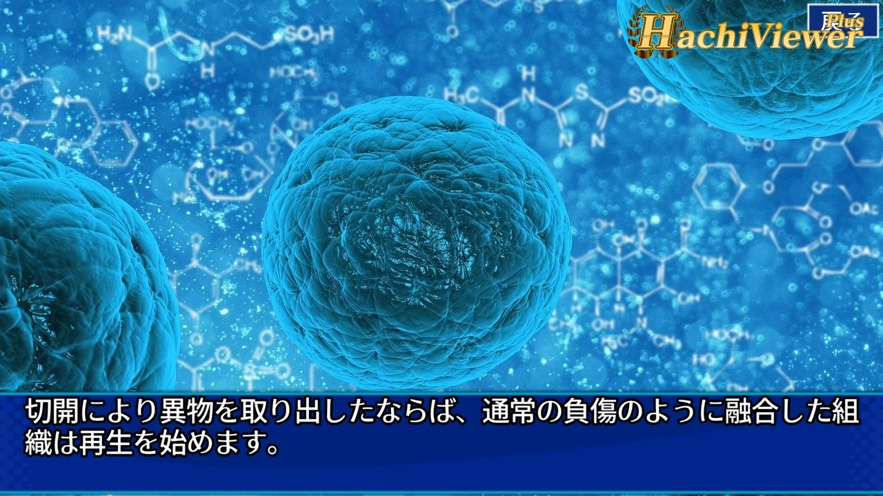 SCP-651 - 人体融合ウイルス - ニコニコ動画